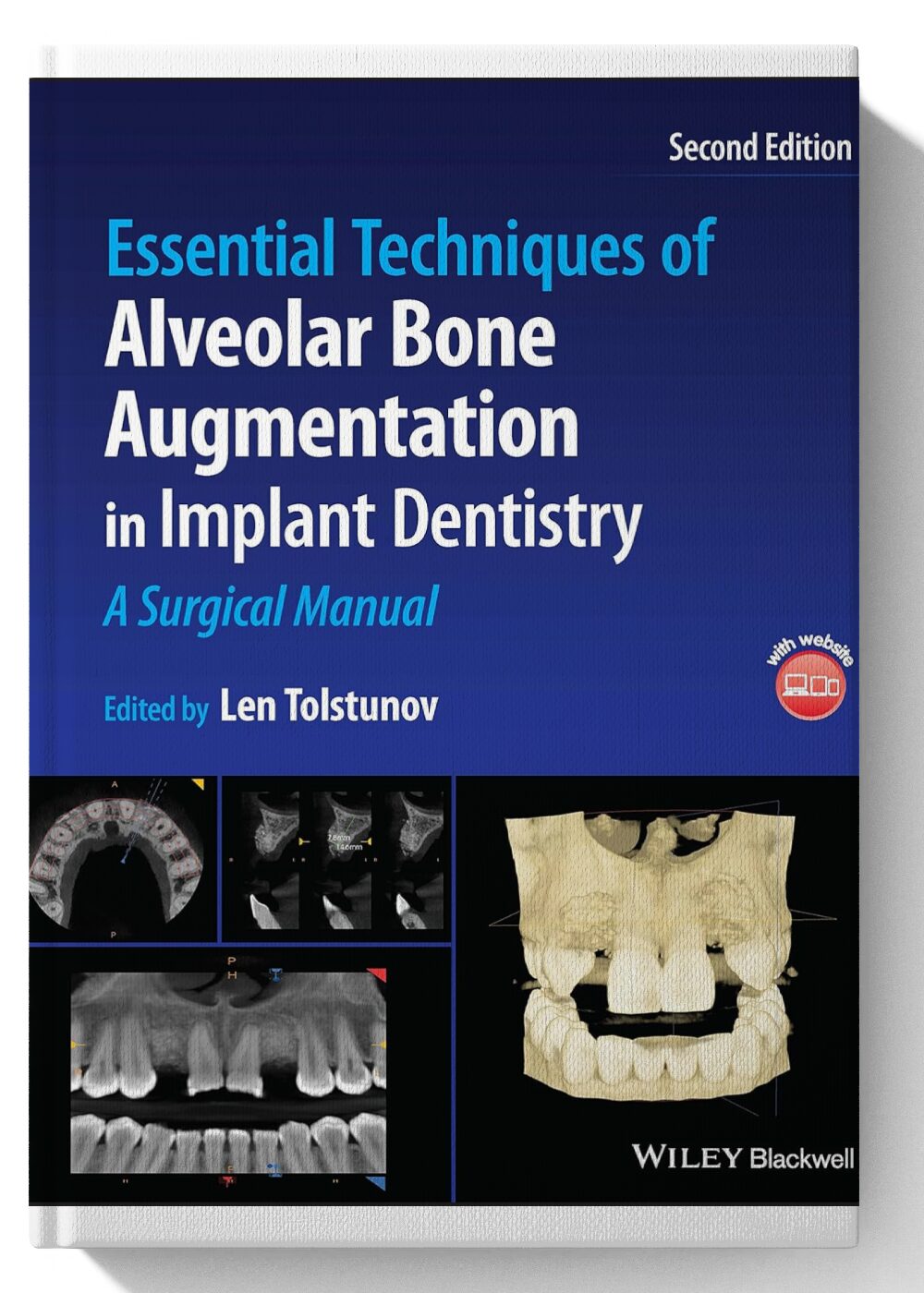 Essential Techniques of Alveolar Bone Augmentation in Implant Dentistry: A Surgical Manual 2nd ...